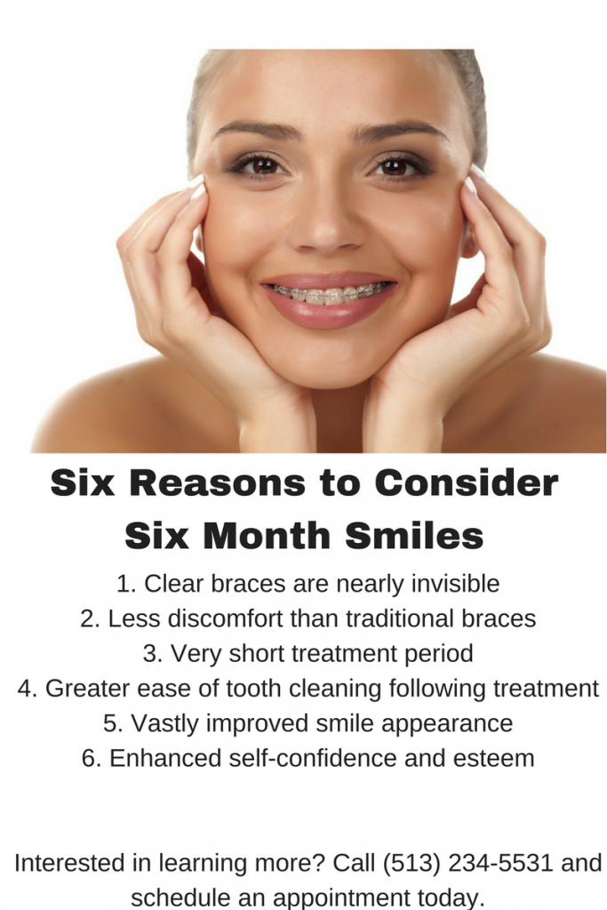 What is Six Month Smiles? | Hardin Advanced Dentistry